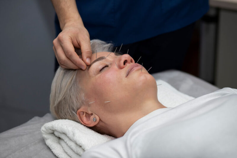 Traditional Chinese Medicine and Acupuncture: A Comprehensive Guide